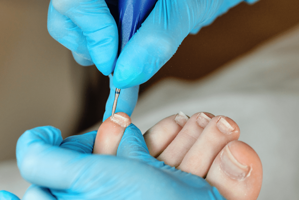 Unhas do Pé Esbranquiçadas e Quebradiças: Significado - Portal Zoe